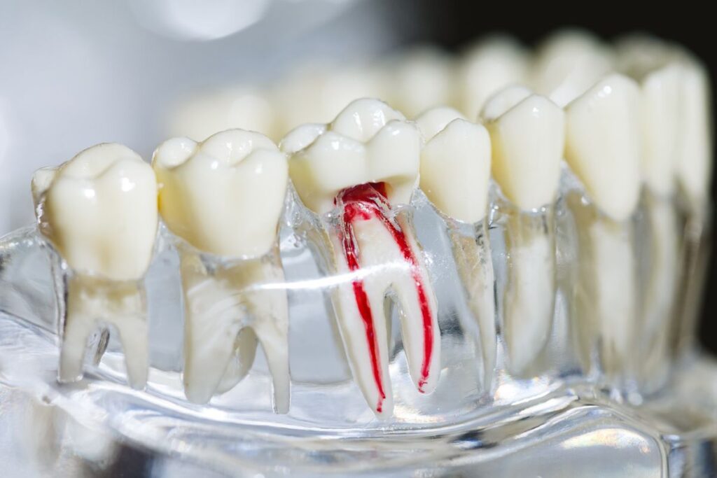 Post-Root Canal Tips: When To Resume Normal Eating